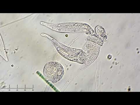 Eating Epistylis - Thai Microcosmos
