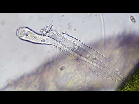 Marine Peritichs & Suctorians - Thai Microcosmos