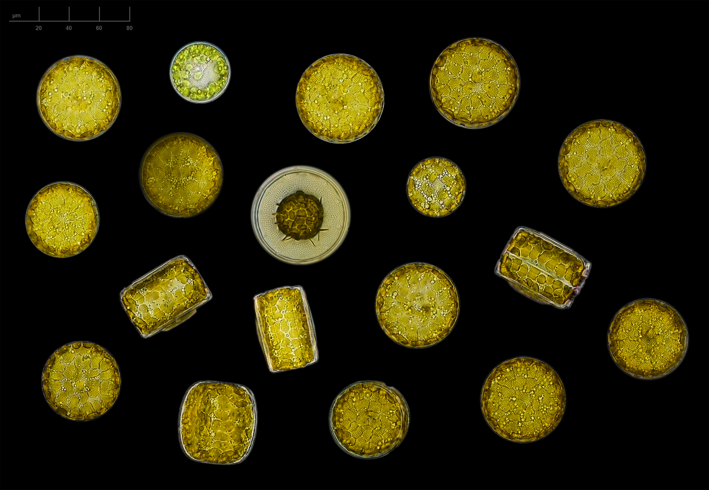 Freshwater Diatoms - Thai Microcosmos