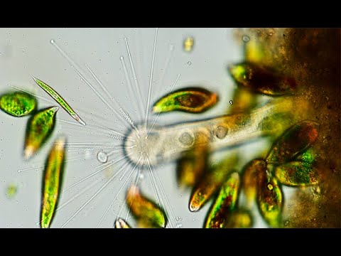 Suctorian Tentacle Movement - Thai Microcosmos