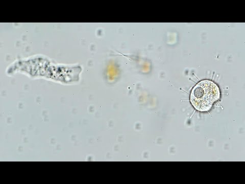 Young Ciliated Suctorian - Thai Microcosmos
